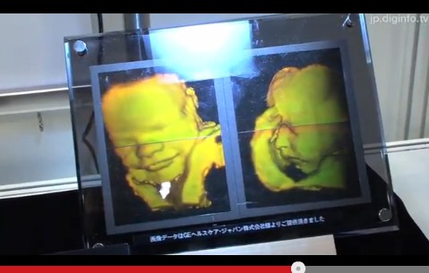 Baby’s First Portrait: Get 3-D Holographic Print of your Unborn Child ...