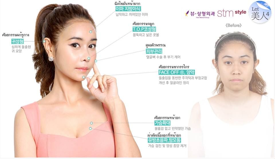 Pikachu goes under the knife at South Korean cosmetic surgery clinic ...