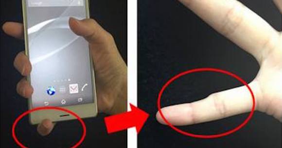 Is smartphone pinky the new text claw? Overuse of mobile devices found ...