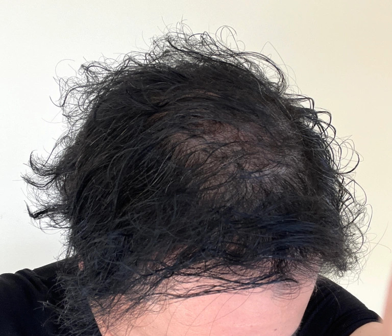 Does getting a perm help hide the thinning hair spots on your head? We ...